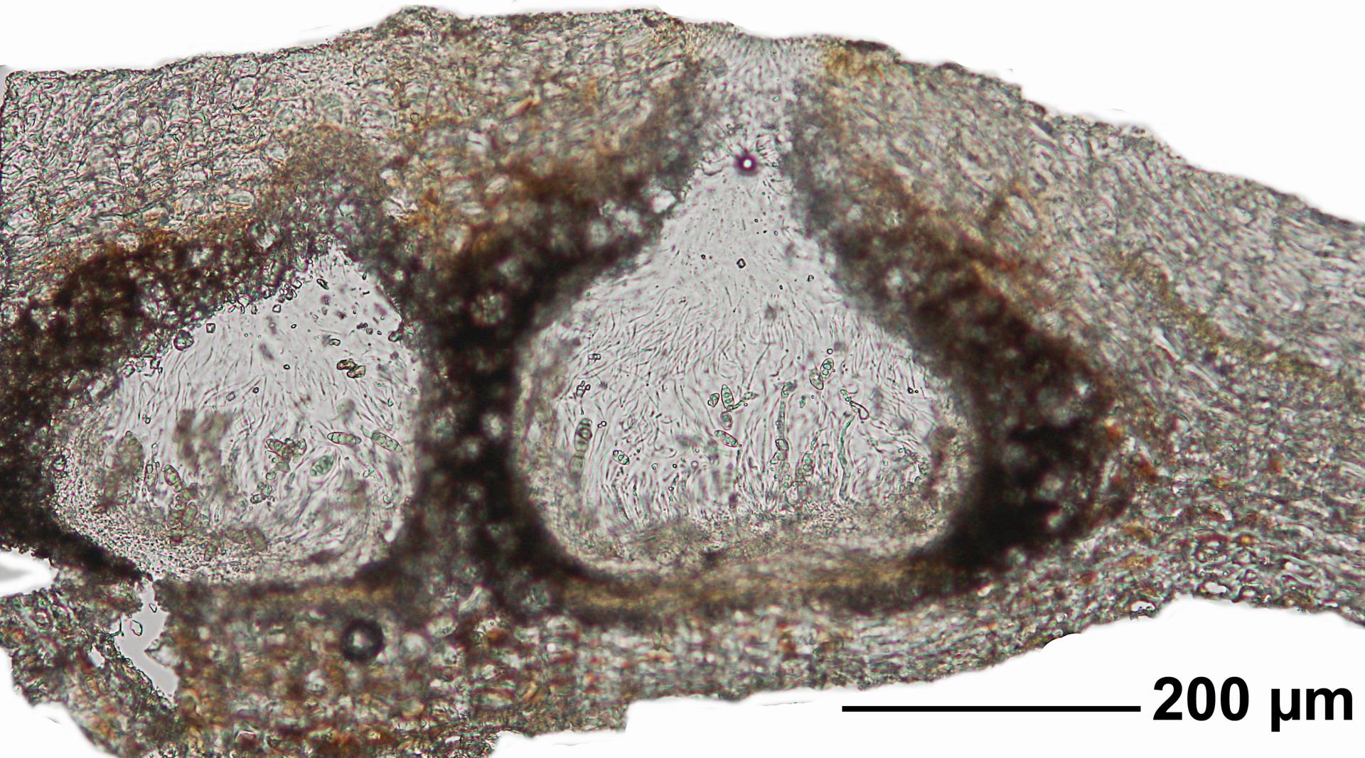 Pyrenula macrospora (Degel.) Coppins & P. James | Azorean Biodiversity ...