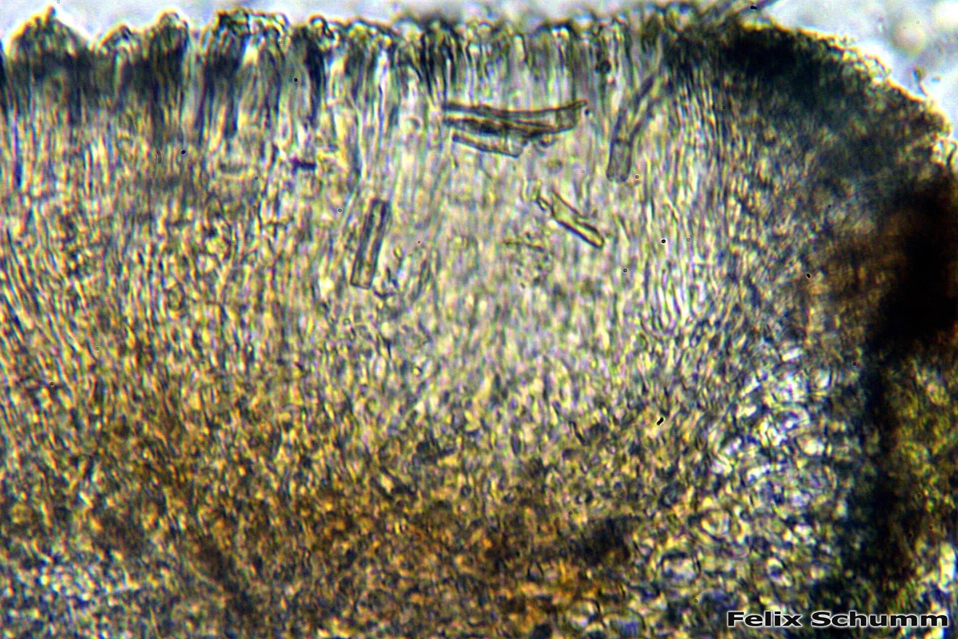 Pectenia plumbea (Lightf.) P.M. Jørg., L. Lindblom, Wedin & S. Ekman ...