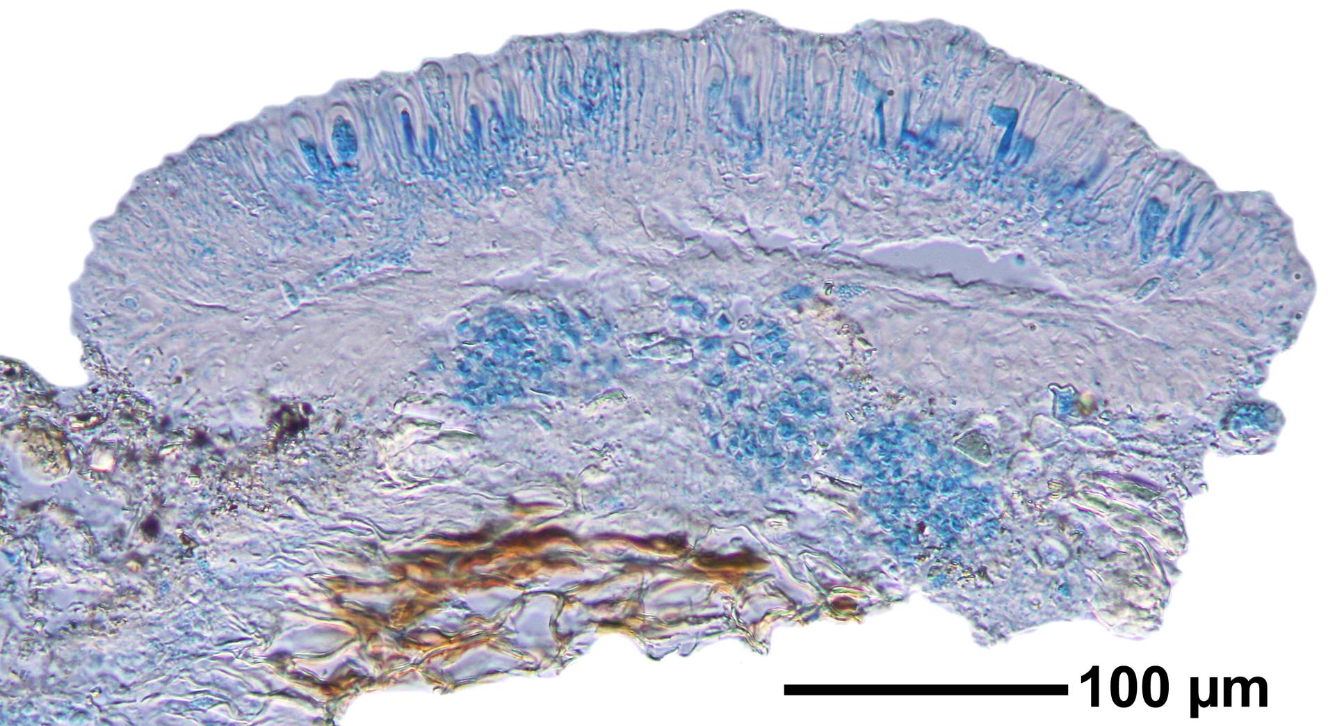Lecania naegelii (Hepp) Diederich & Van den Boom | Azorean Biodiversity ...