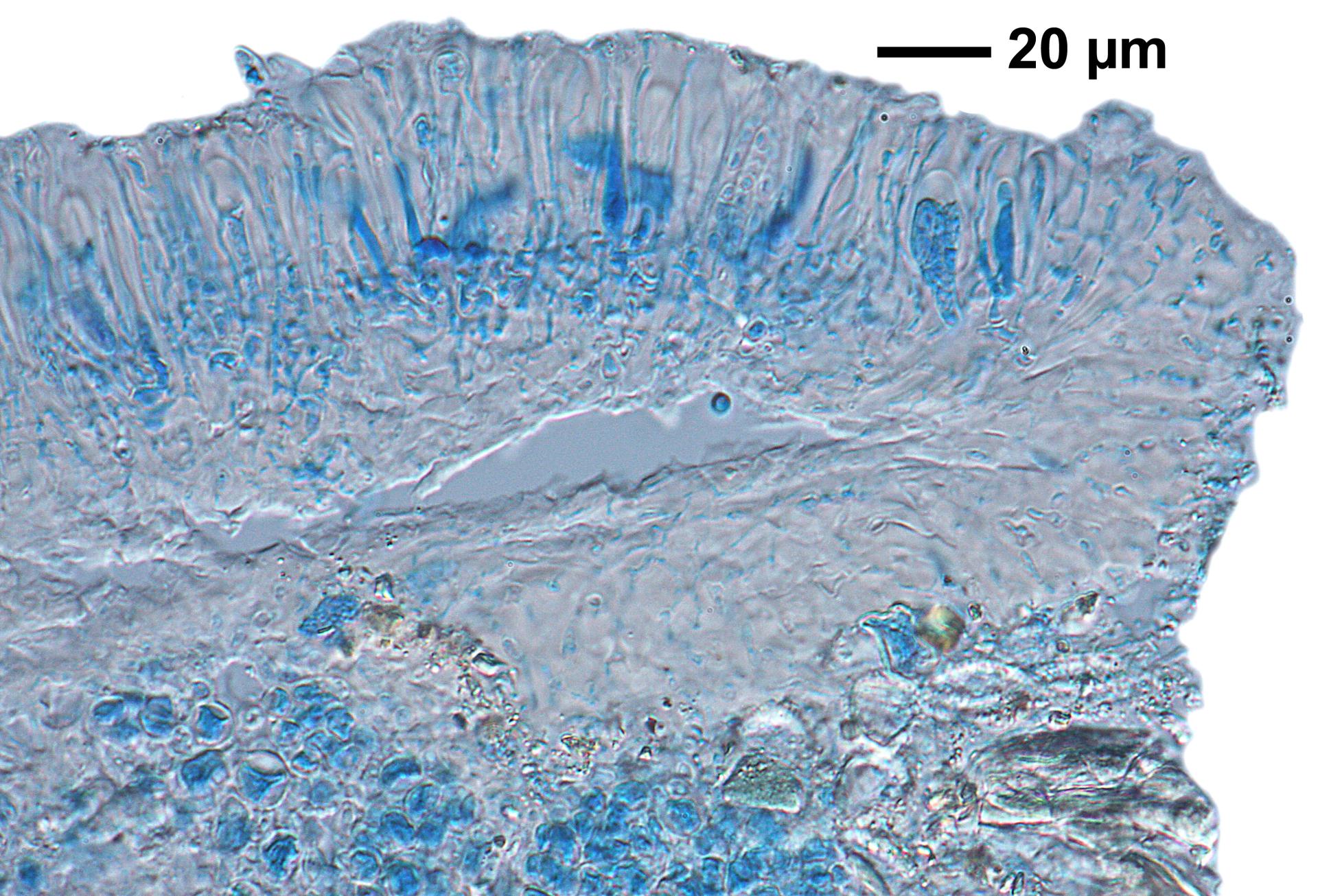 Lecania naegelii (Hepp) Diederich & Van den Boom | Azorean Biodiversity ...