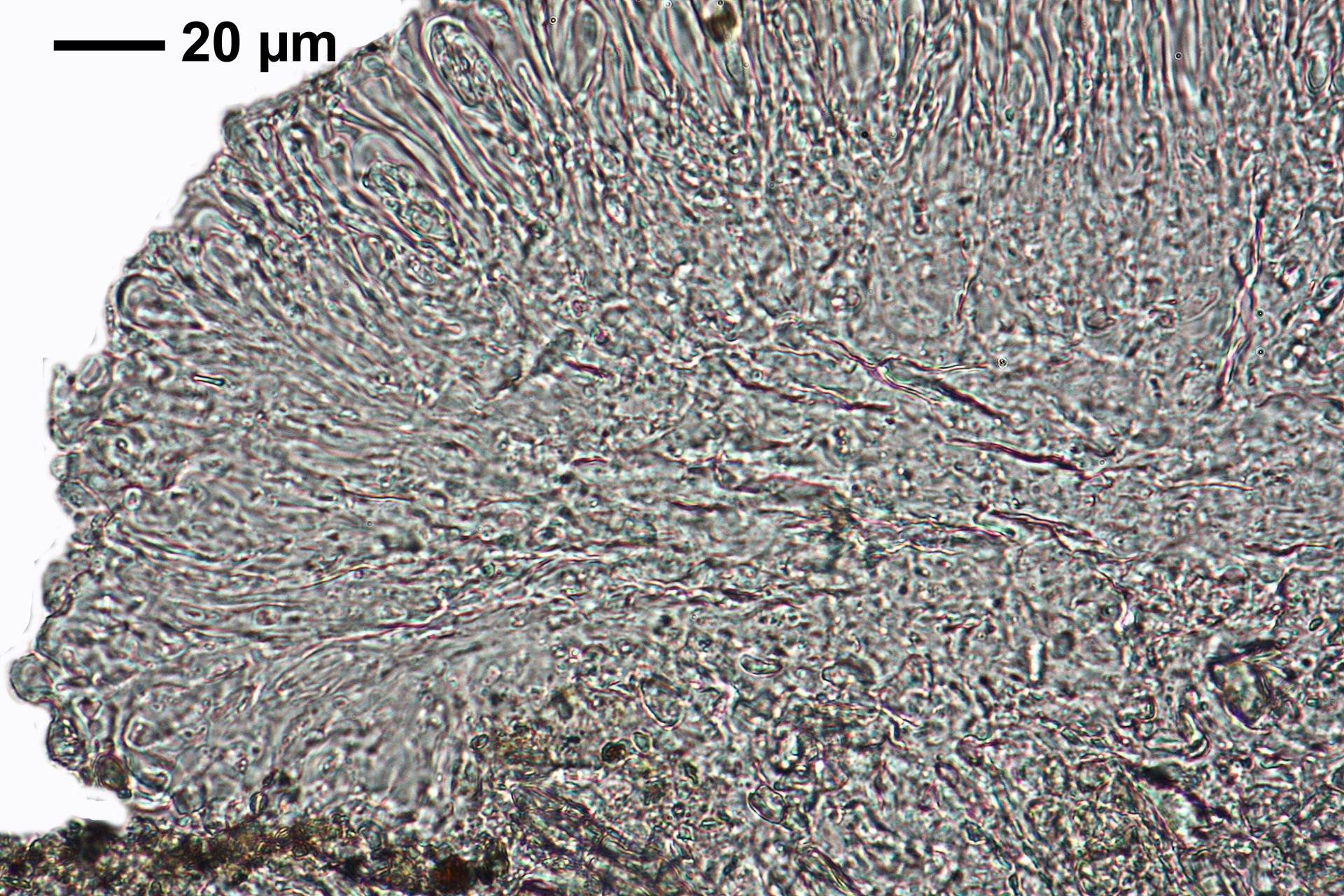 Lecania naegelii (Hepp) Diederich & Van den Boom | Portal de la ...