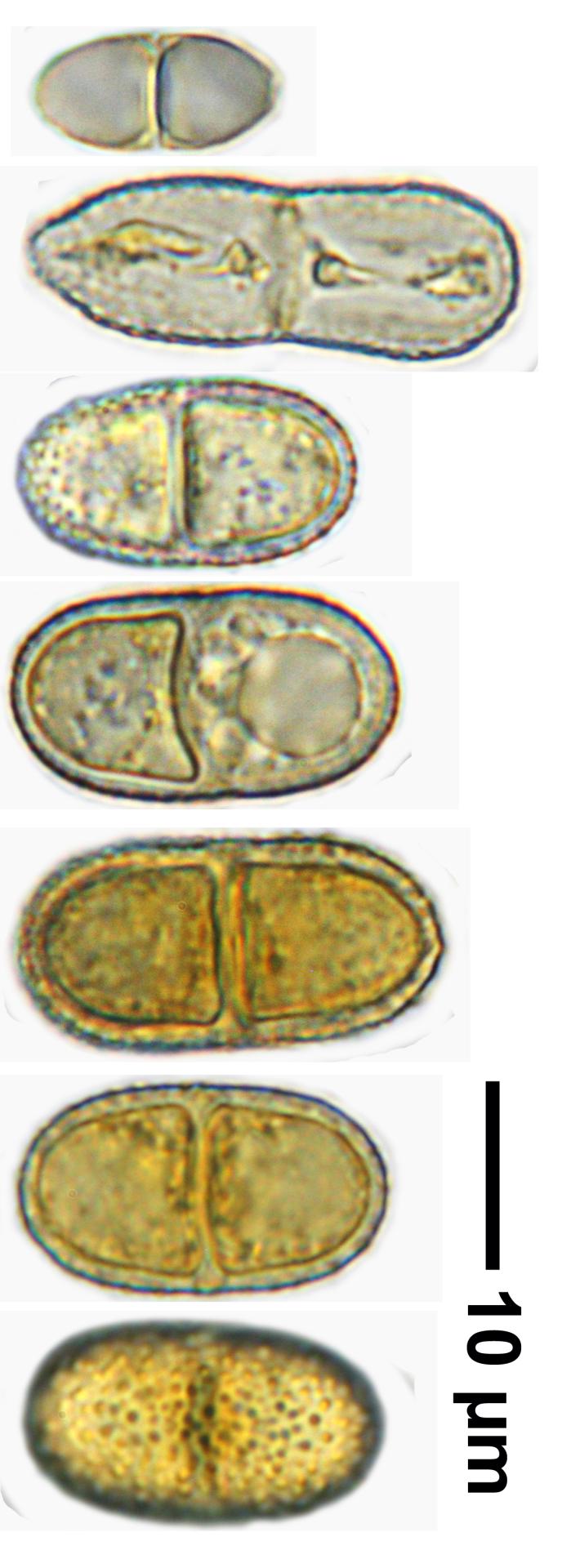 Acrocordia gemmata (Ach.) A. Massal., 1854 | Portal de la Biodiversidad ...